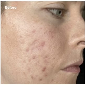 About US - Skin Laundry UK - We Made Laser Facials a Thing